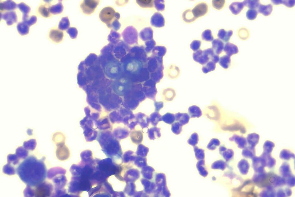 Blastomycosis: A Fungus Among Us - BluePearl Pet Hospital
